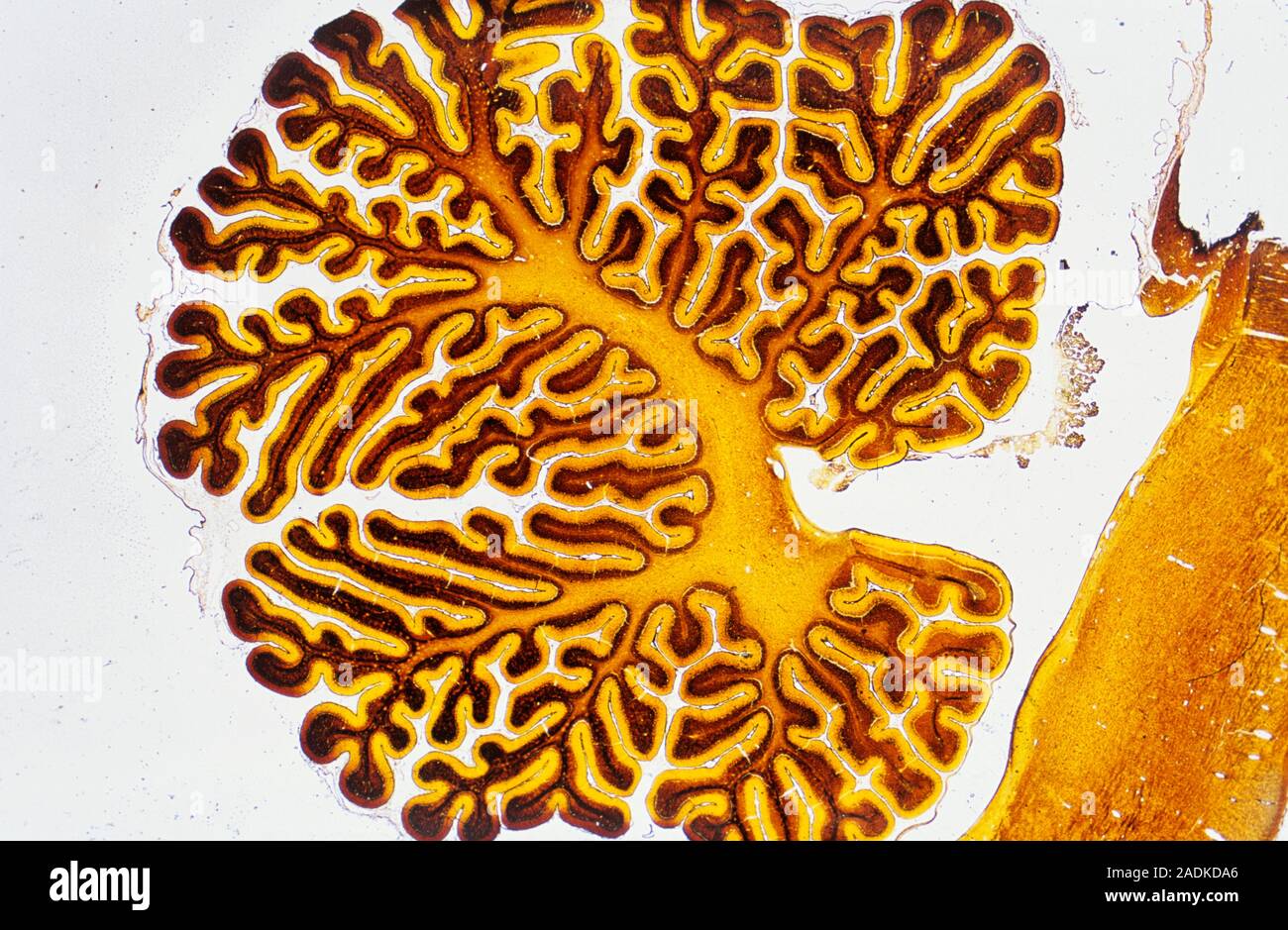 Brain tissue. Light micrograph of a section through the cerebellum of ...