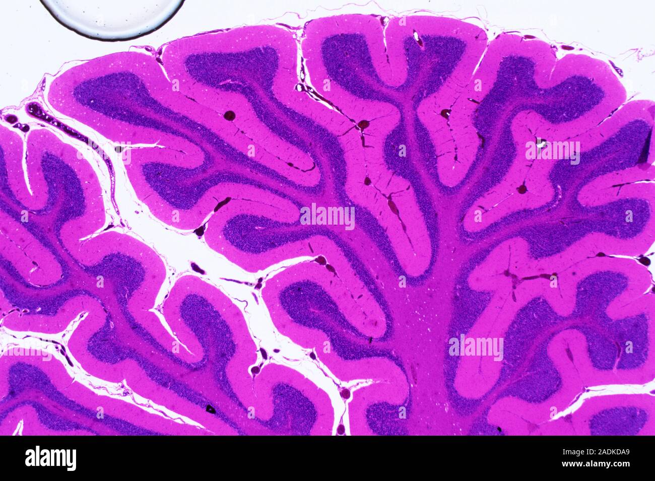 Brain tissue. Light micrograph of a section through the cerebellum of ...
