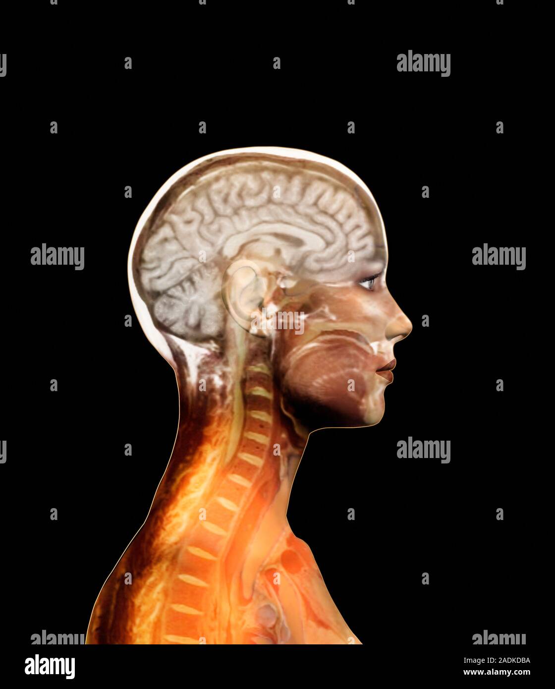 Brain. Computer artwork of a side view of a healthy human brain. At ...