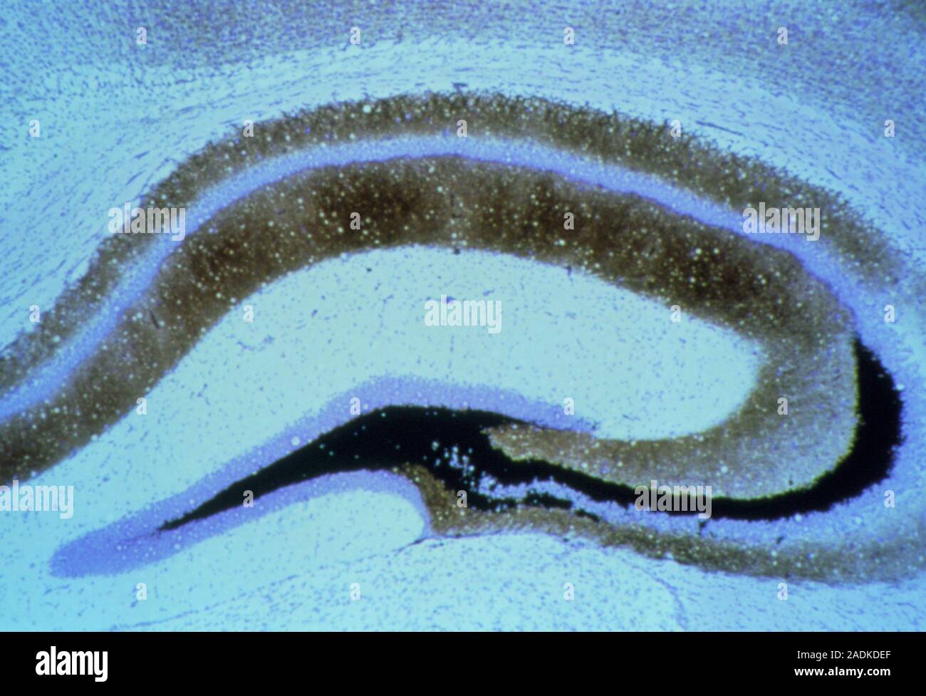 Healthy sheep brain. Light micrograph of a sagittal section through the ...