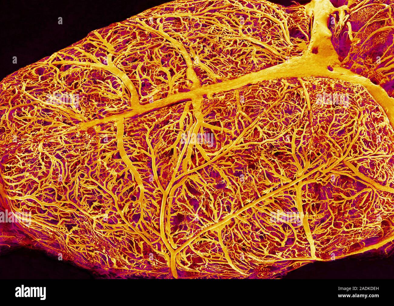 Blood vessels in the brain of a rat, coloured scanning electron ...