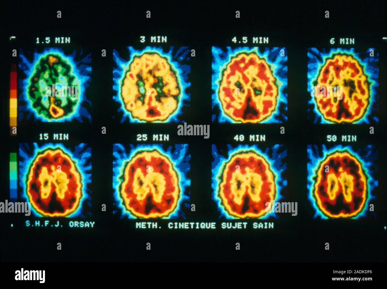 Series of eight PET scans (positron emission tomography) of axial ...
