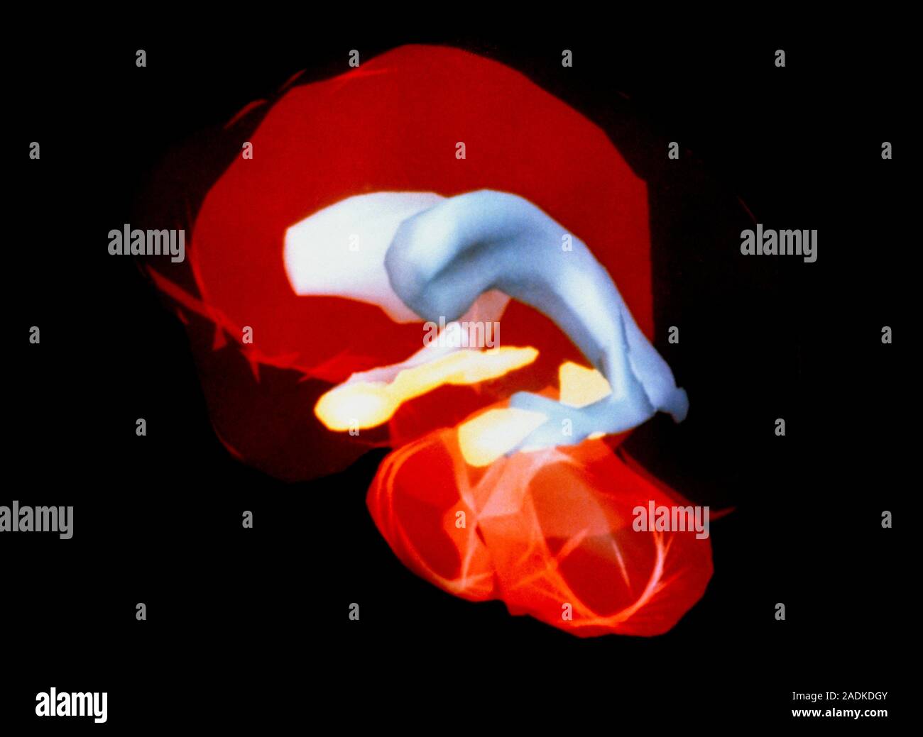 3-D magnetic resonance image (MRI) of a normal adult brain. The ...