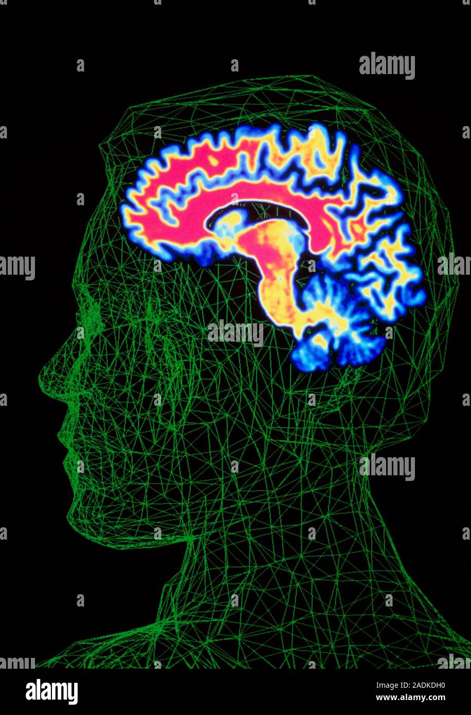 Brain scan superimposed on a contour map of the human head. The green ...