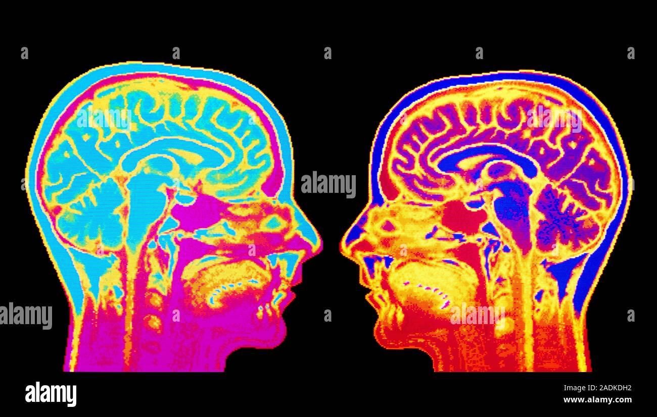 Pair of false-colour Magnetic Resonance Images (MRI) of mid-sagittal ...