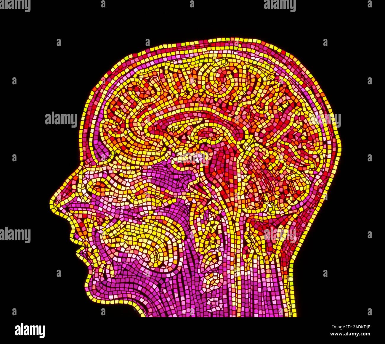 Brain scan. Coloured magnetic resonance imaging (MRI) scan of a healthy ...