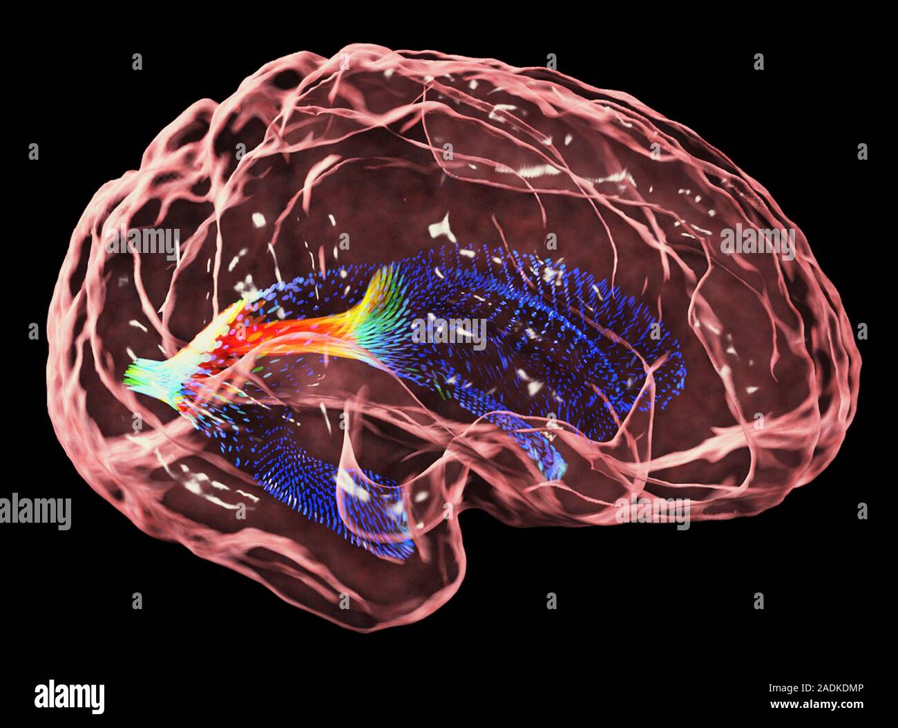 Brain variation. Coloured composite three- dimensional scan of the ...