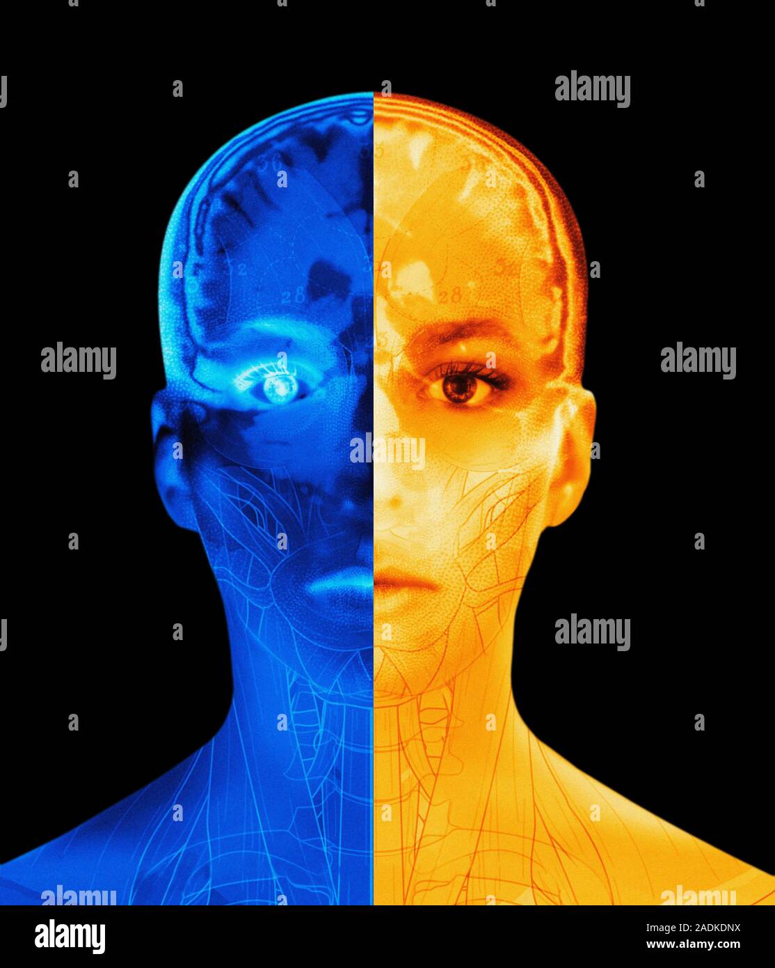 Brain scan. Computer artwork of a human head with a brain scan showing ...