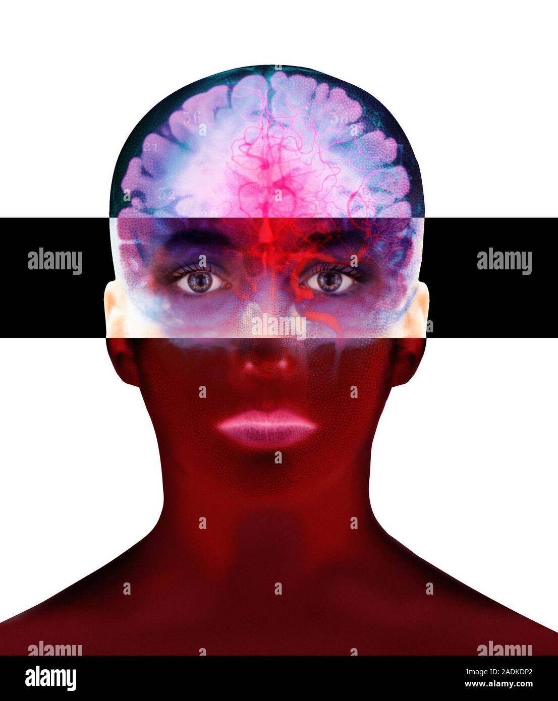 Brain scan. Computer artwork of a human head with a brain scan showing ...