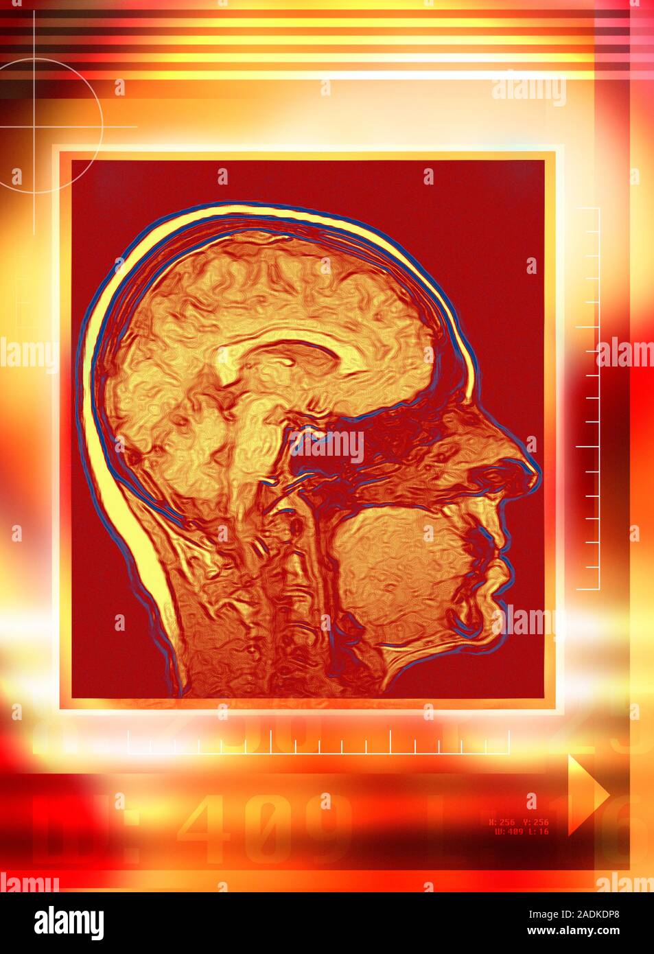 Brain. Coloured magnetic resonance imaging (MRI) scan of a sagittal section through a healthy ...