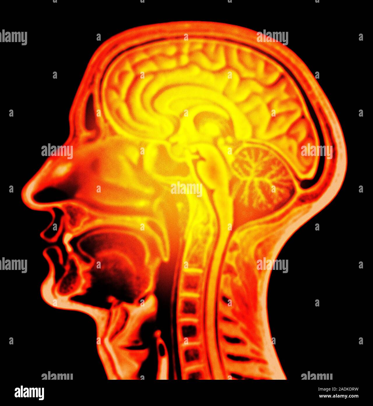 Brain scan. This is a computer artwork based on a sagittal (side view ...