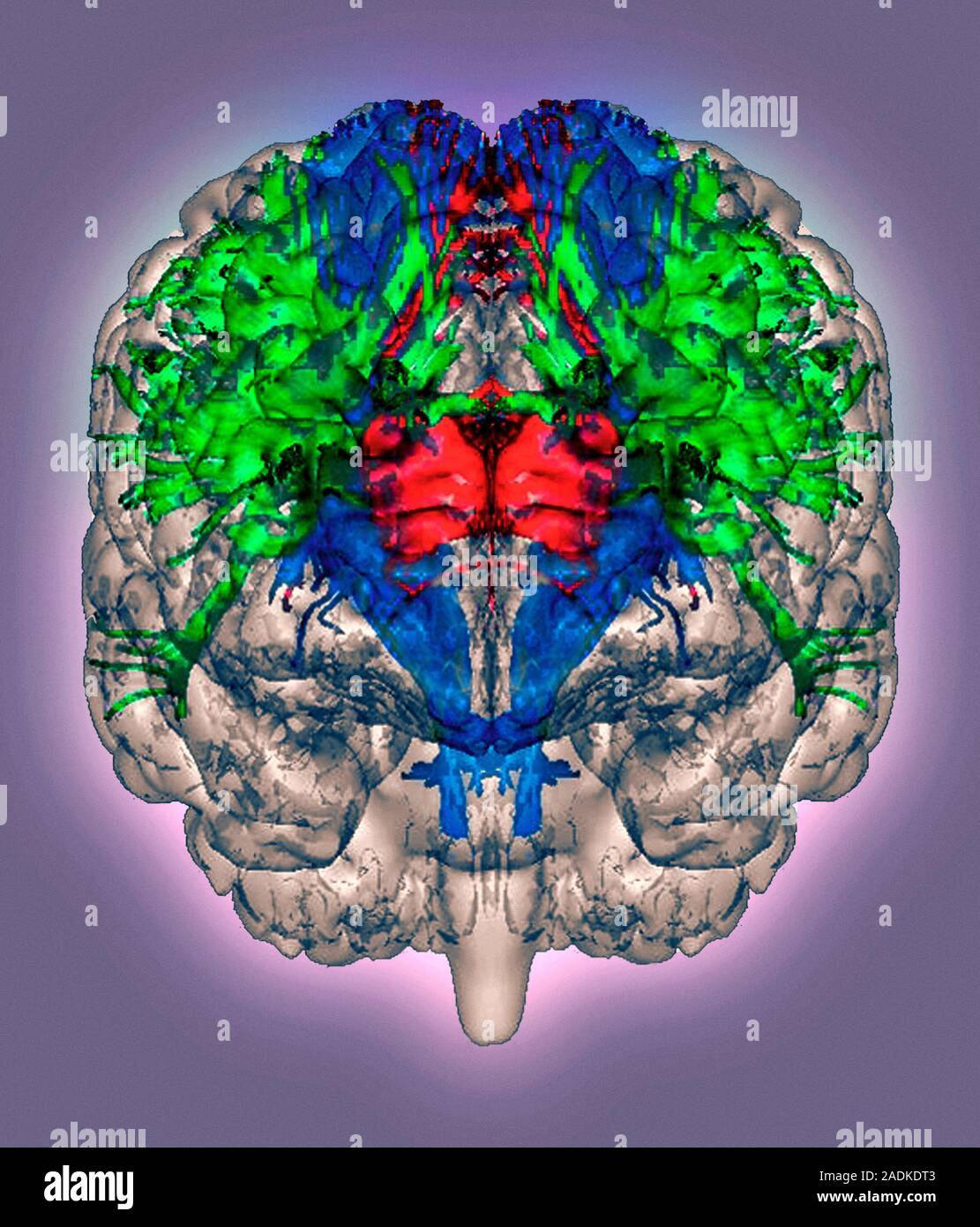 White matter fibres. Frontal coloured 3D diffusion tensor imaging (DTI) scan of a healthy brain ...