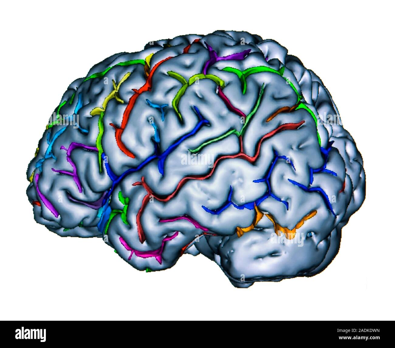 Advanced MRI brain scan. This 3D magnetic resonance imaging (MRI) scan ...