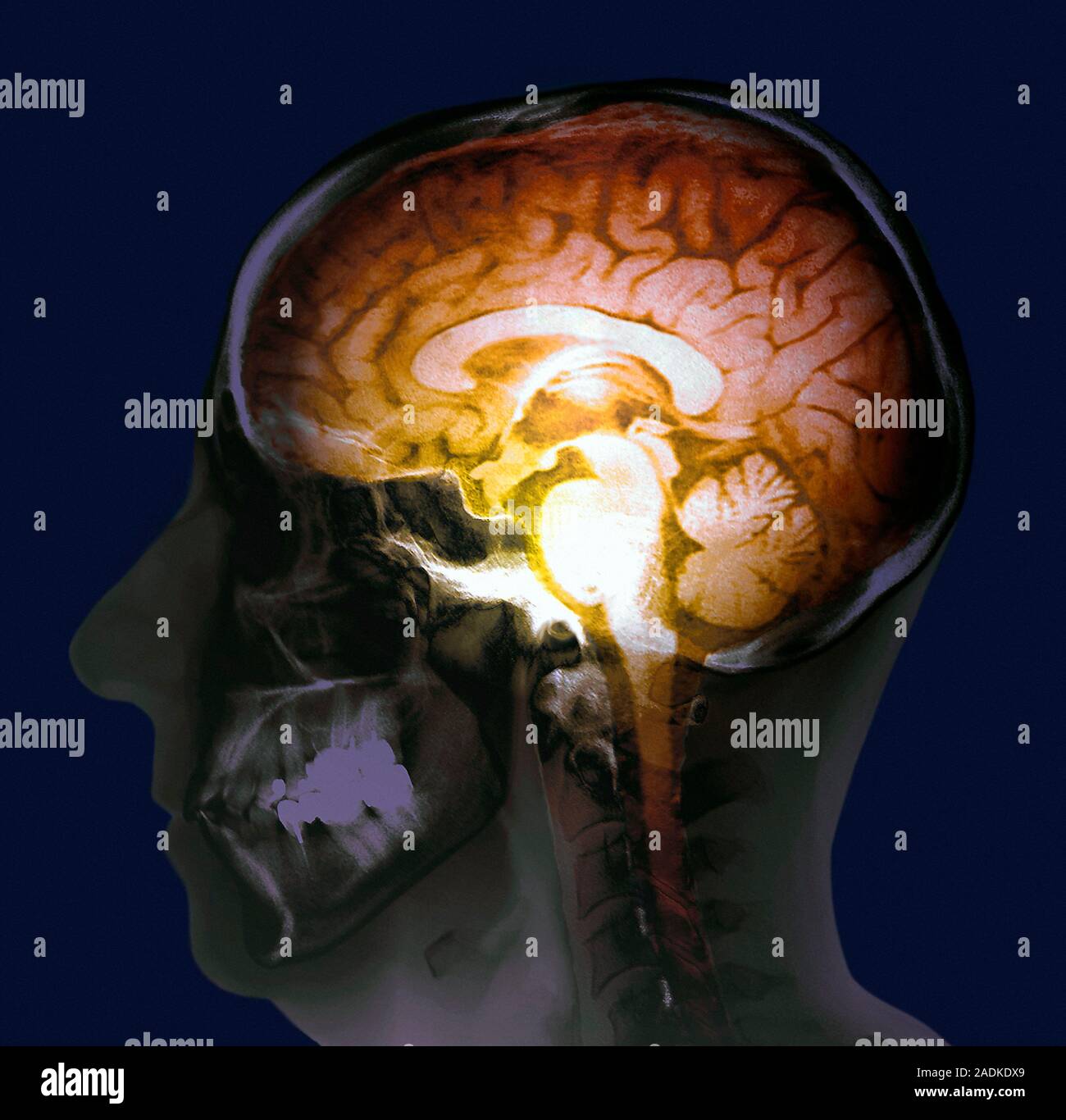 Normal brain, coloured magnetic resonance imaging (MRI) scan. Sagittal (side) view of a human ...