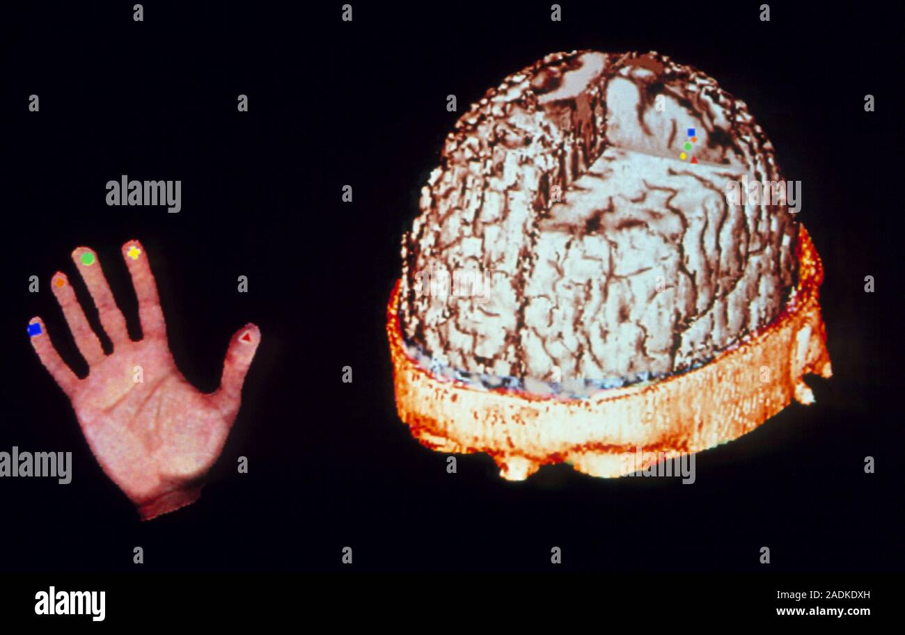 Brain-hand control from MEG scan. Computer image showing a 3-D human ...