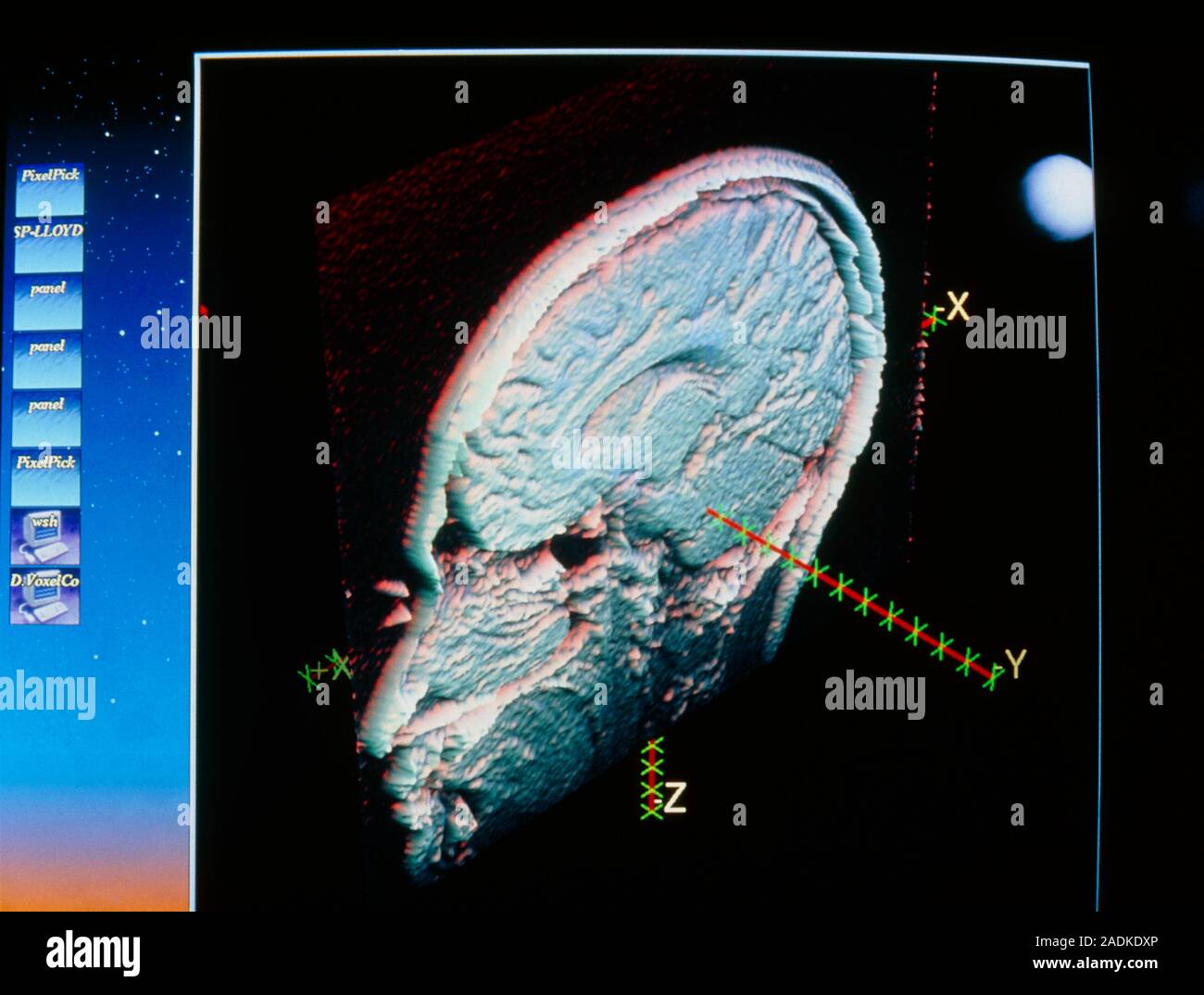MEG brain signal. Computer image of a section through the human head ...