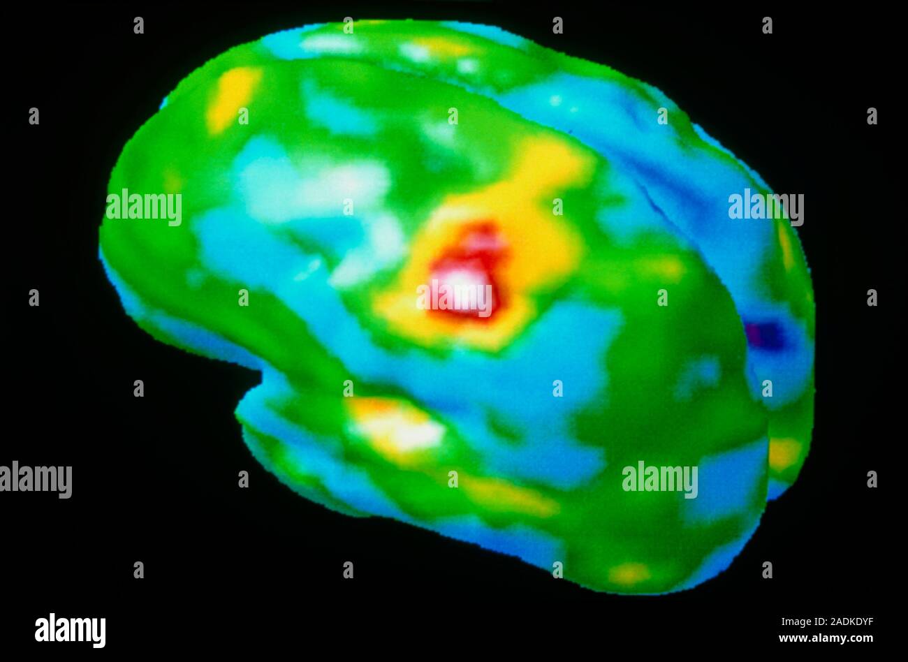 Brain's motor centre. Coloured three-dimensional positron emission ...