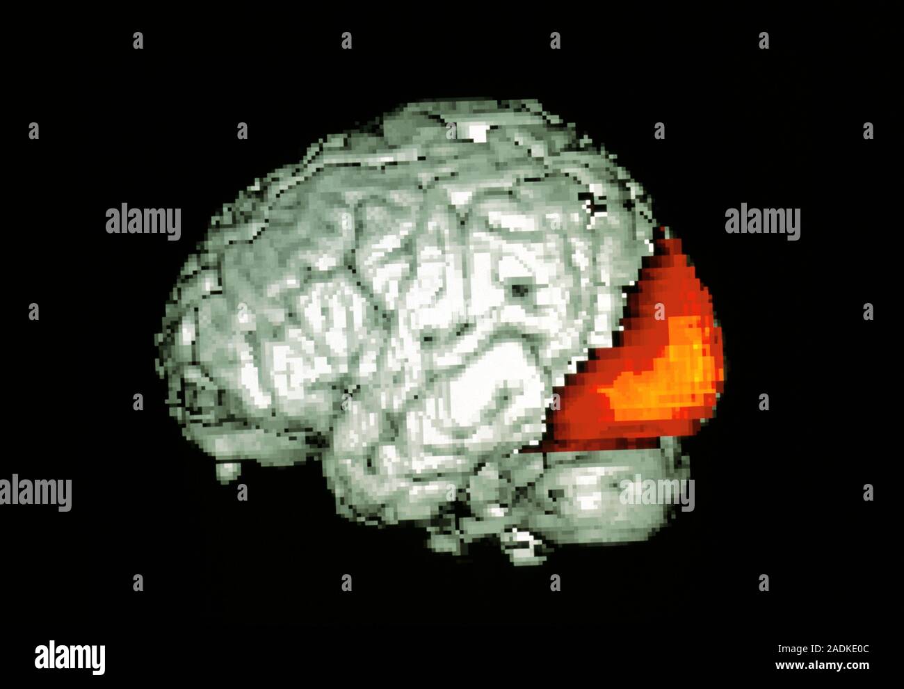 Brain viewing images. Coloured positron emission tomography (PET) scan ...