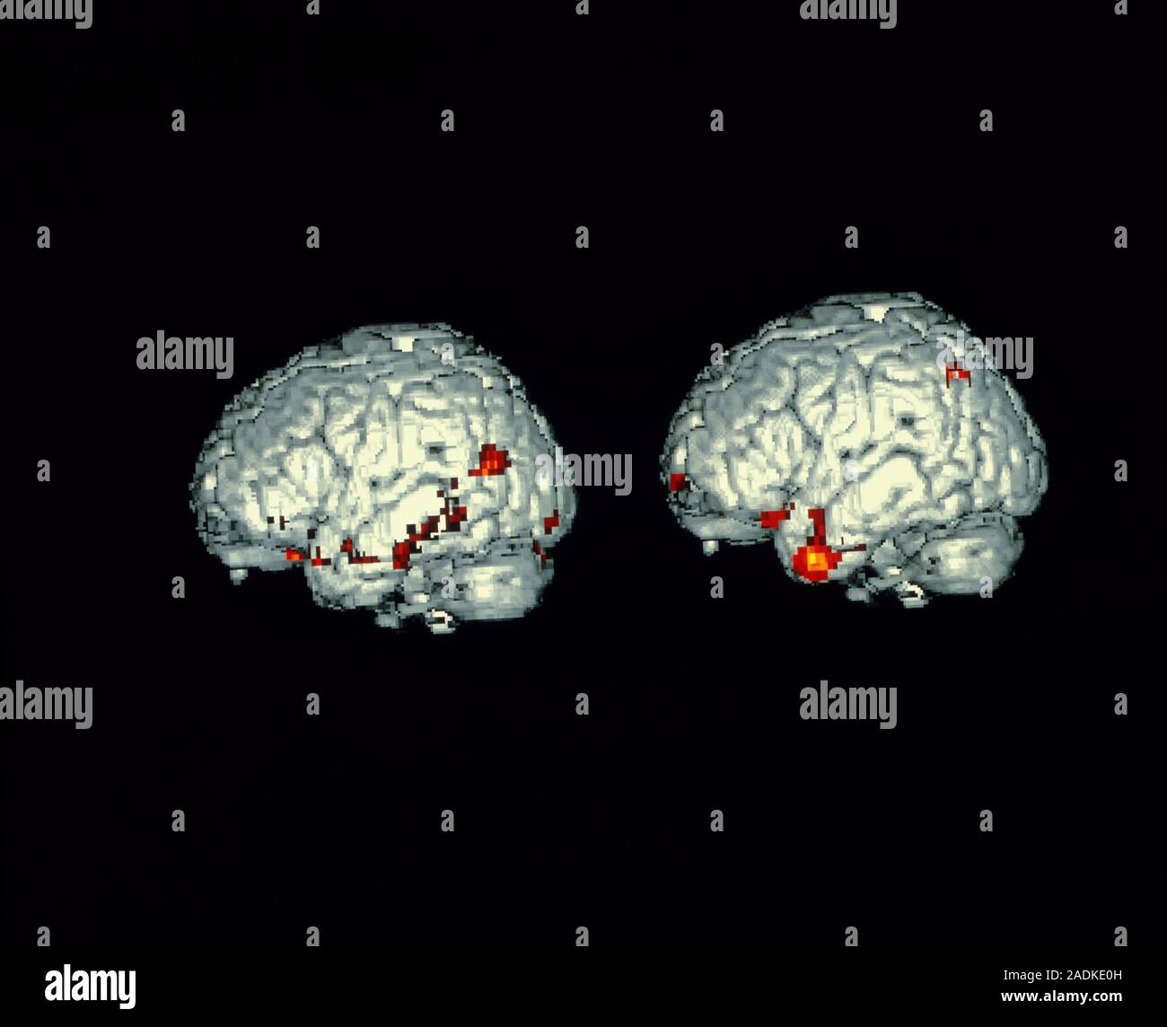 Language-cognition brain activity. Coloured posit- ron emission ...
