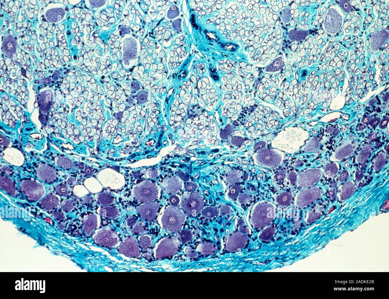 Spinal ganglion. Light micrograph of a cross section through a spinal ...