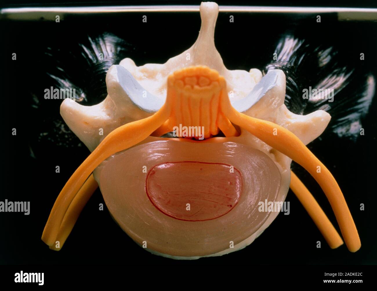 Intervertebral disc. Model of one of the intervertebral discs (at lower ...
