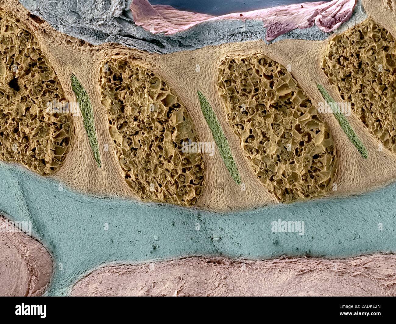 Foetal spinal column. Coloured scanning electron micrograph (SEM) of ...