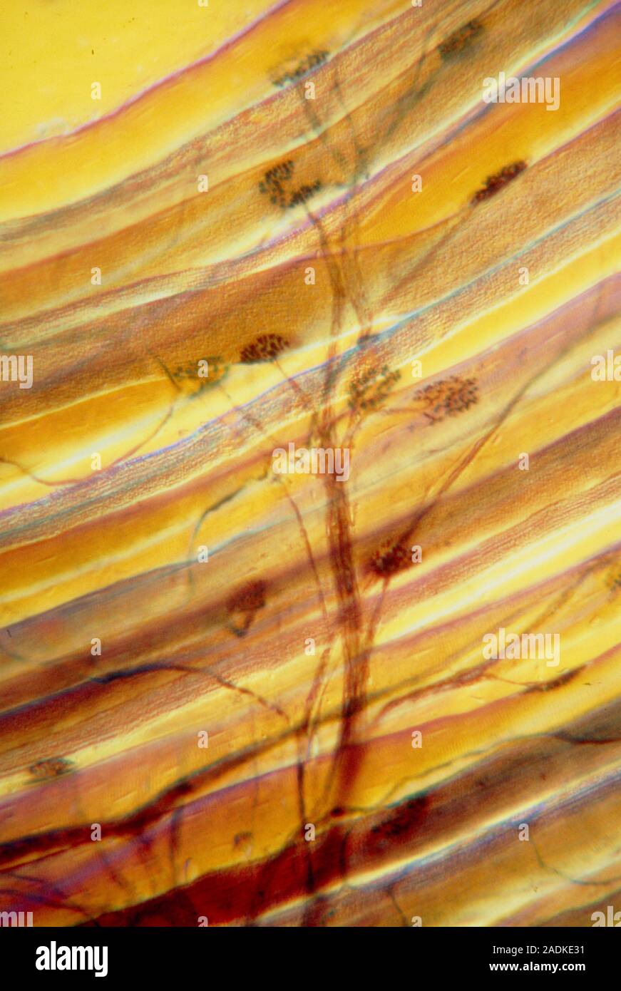Light micrograph of synapses between a motor neurone (tree-like ...