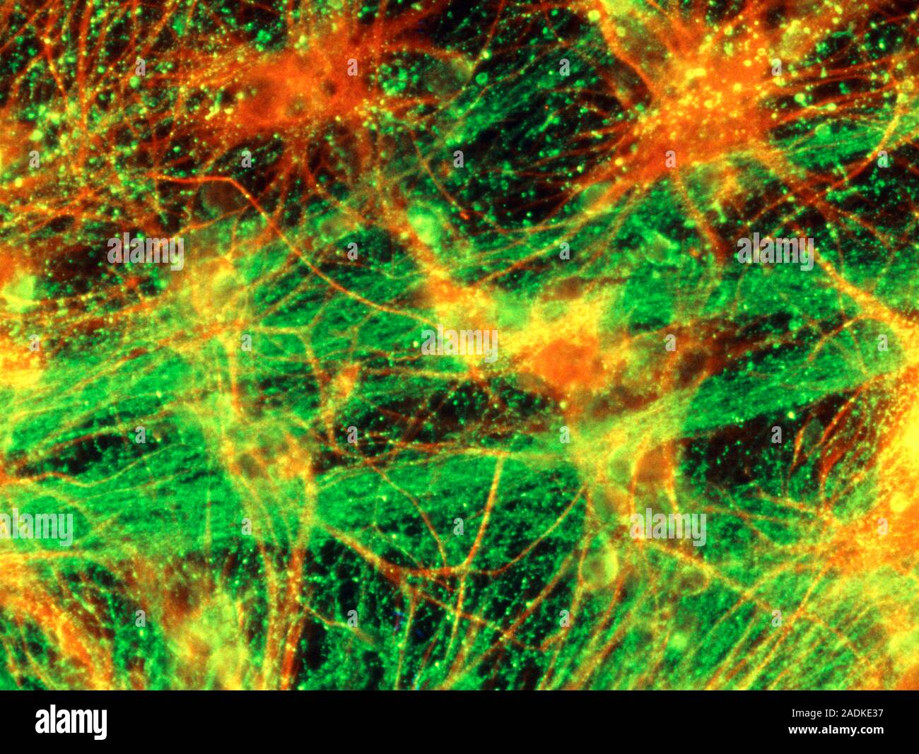 Immunofluorescent Light Micrograph of a network of neurons and ...