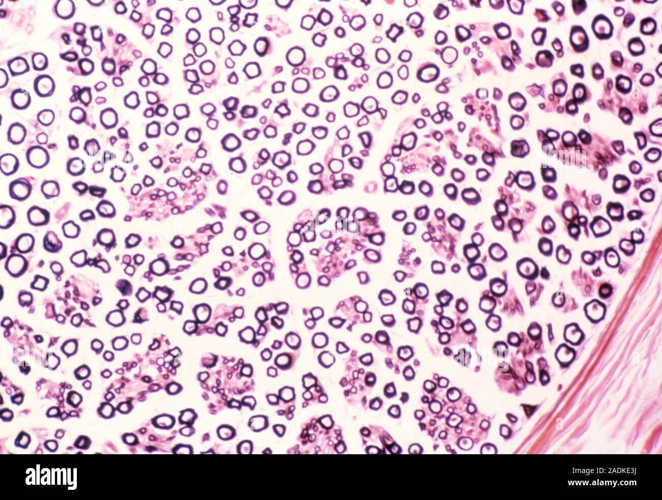 Peripheral nerve. Light micrograph of a cross section through an osmium ...