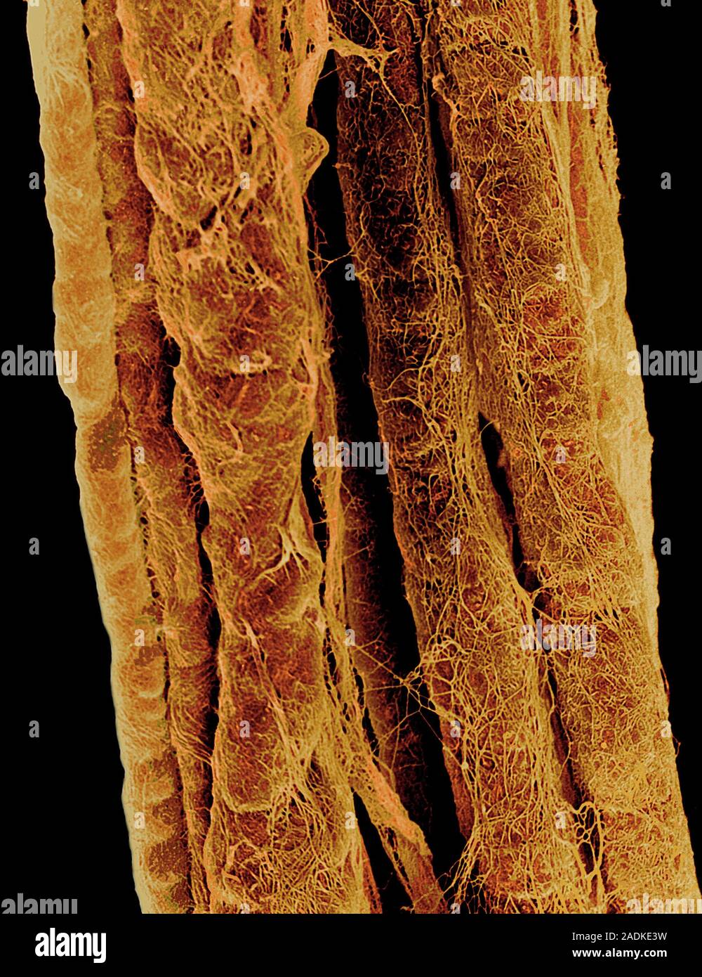 Nerve fibres. Coloured scanning electron micrograph (SEM) of some nerve ...