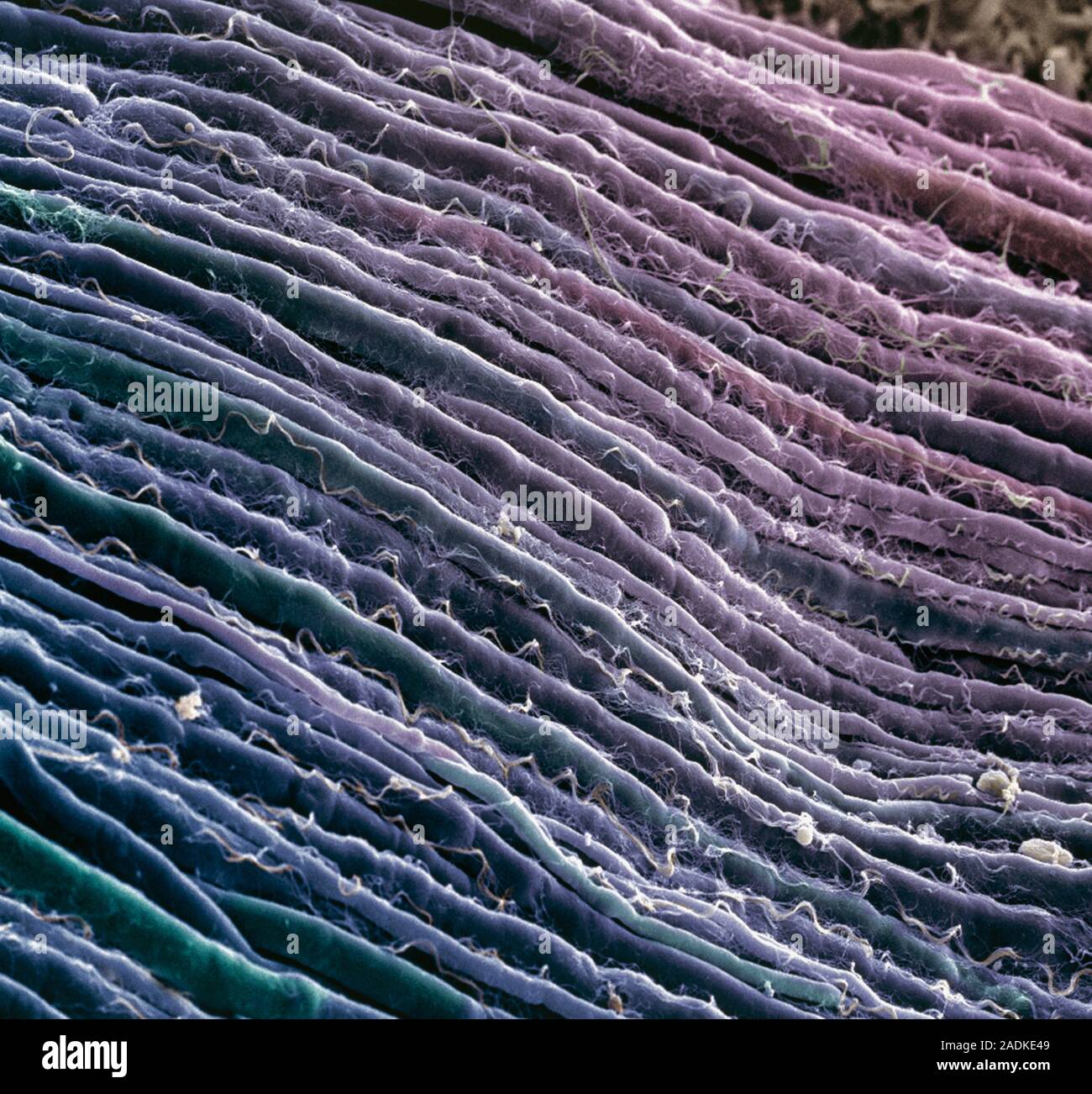 Nerve fibres. Coloured scanning electron micrograph (SEM) of parallel ...
