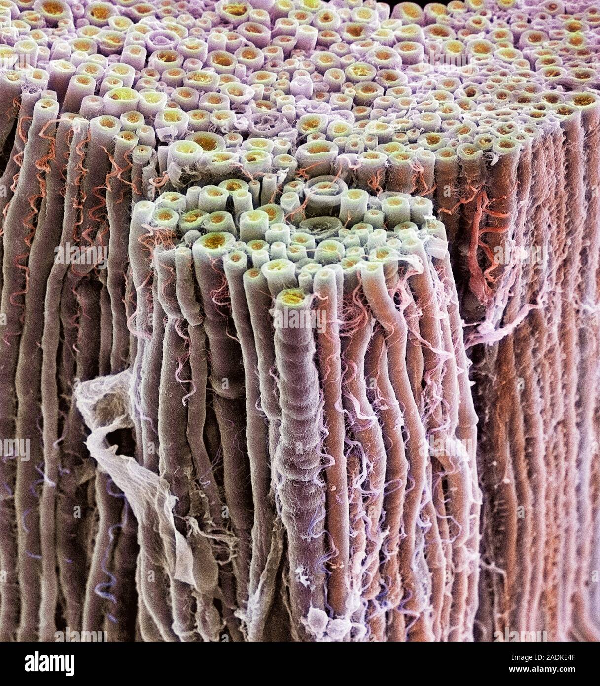 Nerve fibres. Coloured scanning electron micrograph (SEM) of a cut ...