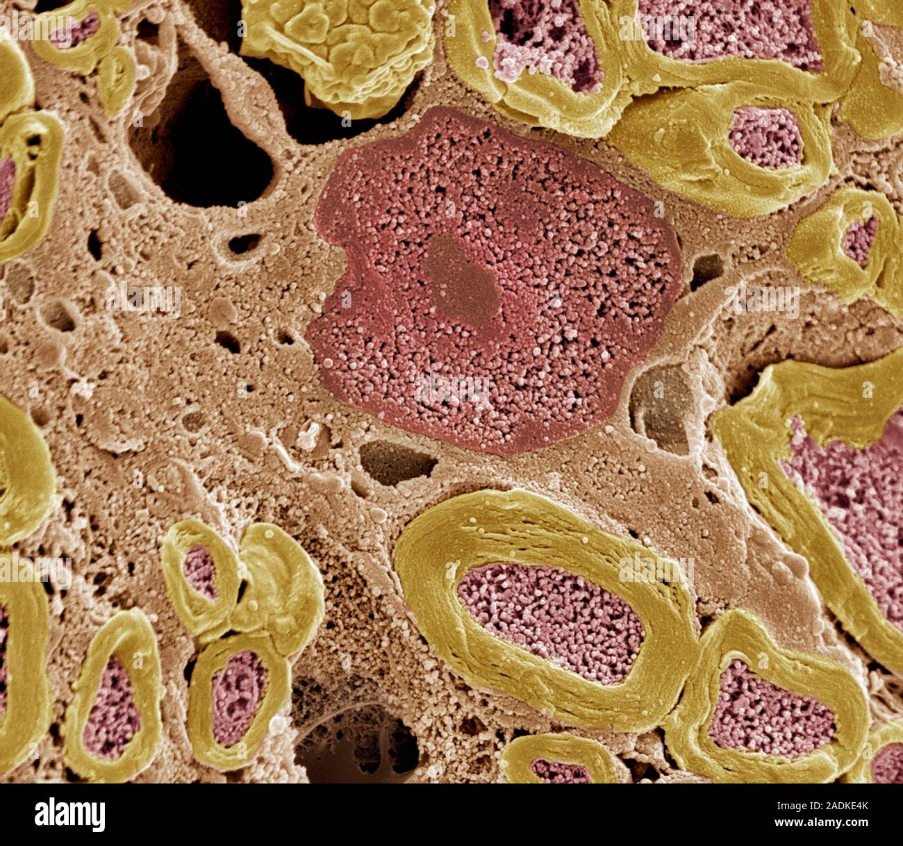 Peripheral nerves. Coloured scanning electron micrograph (SEM) of a ...