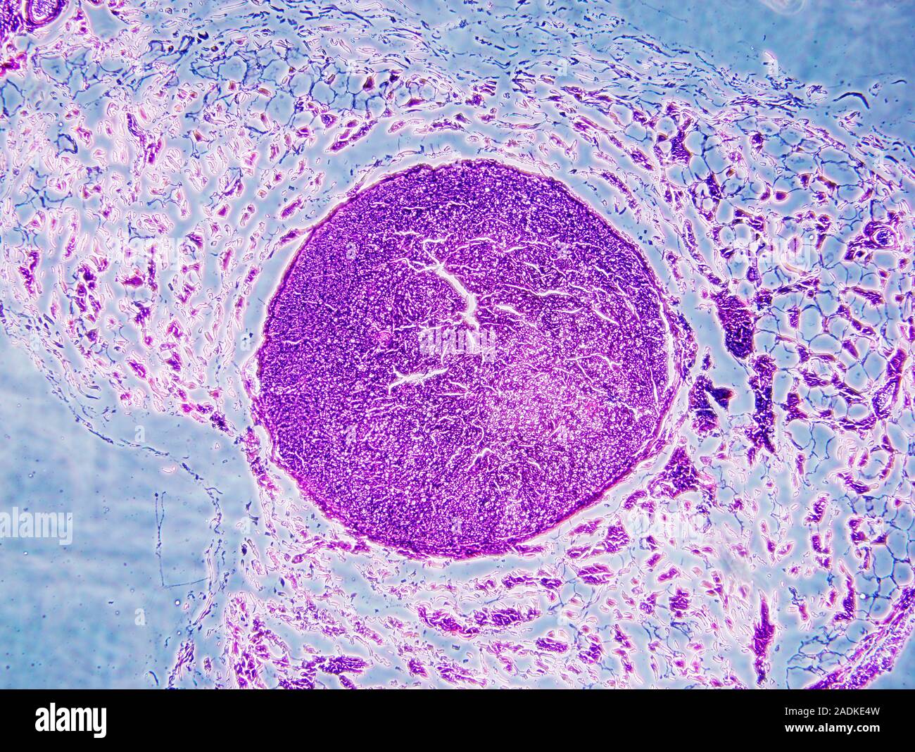 Peripheral nerve. Coloured light micrograph (LM) of a section through a ...