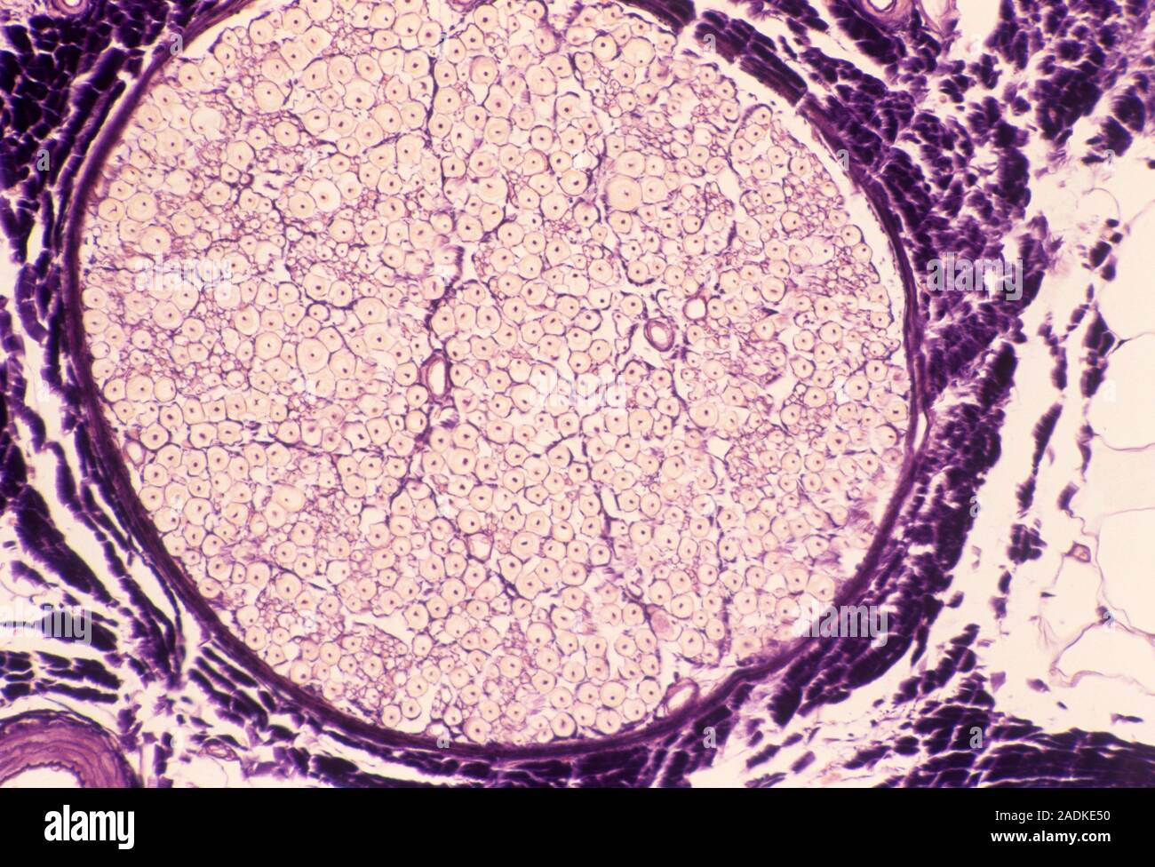 Nerve fibres. Light micrograph of a transverse section through the ...
