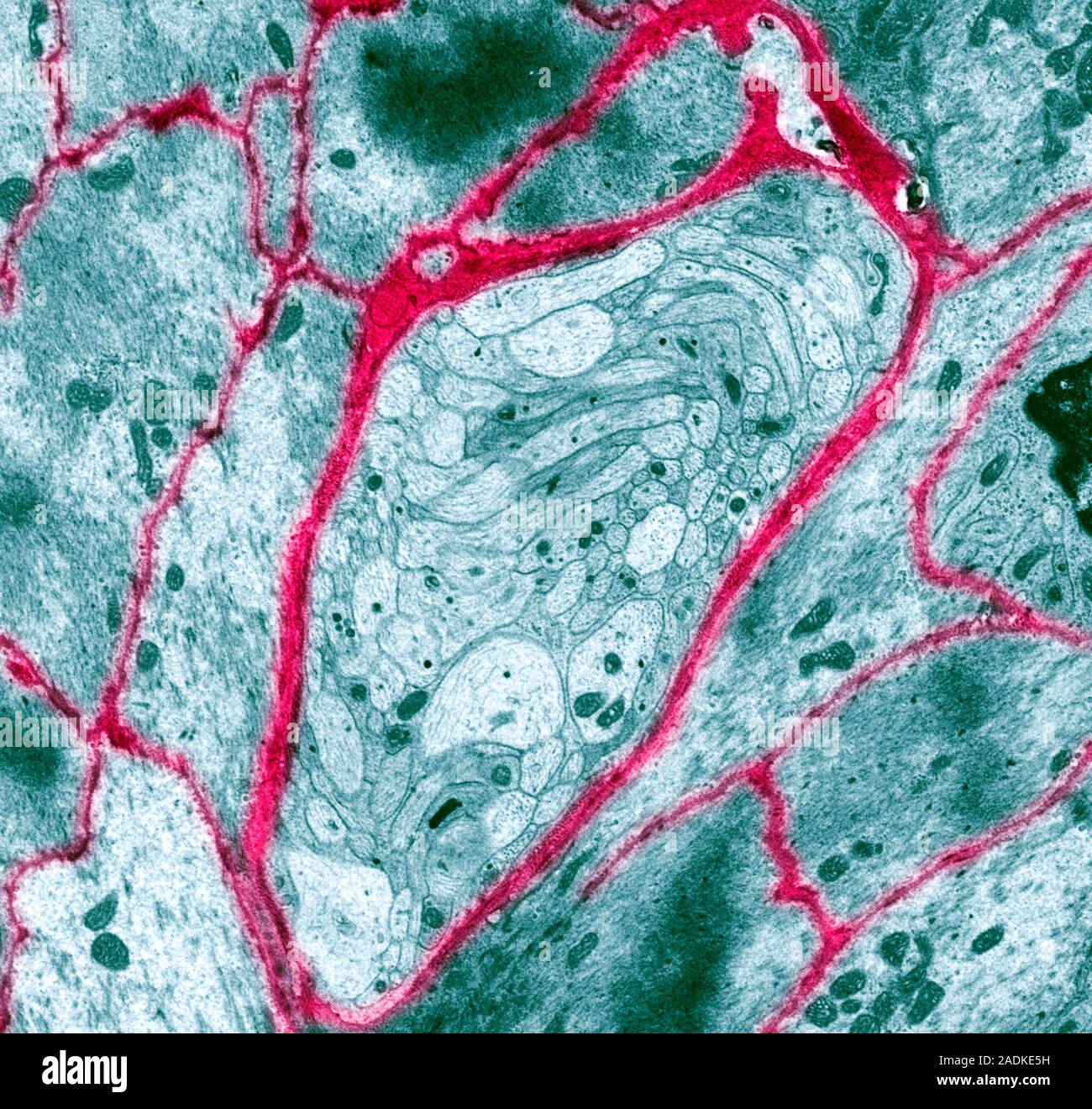 Unmyelinated intestinal nerve fibre. Coloured transmission electron ...