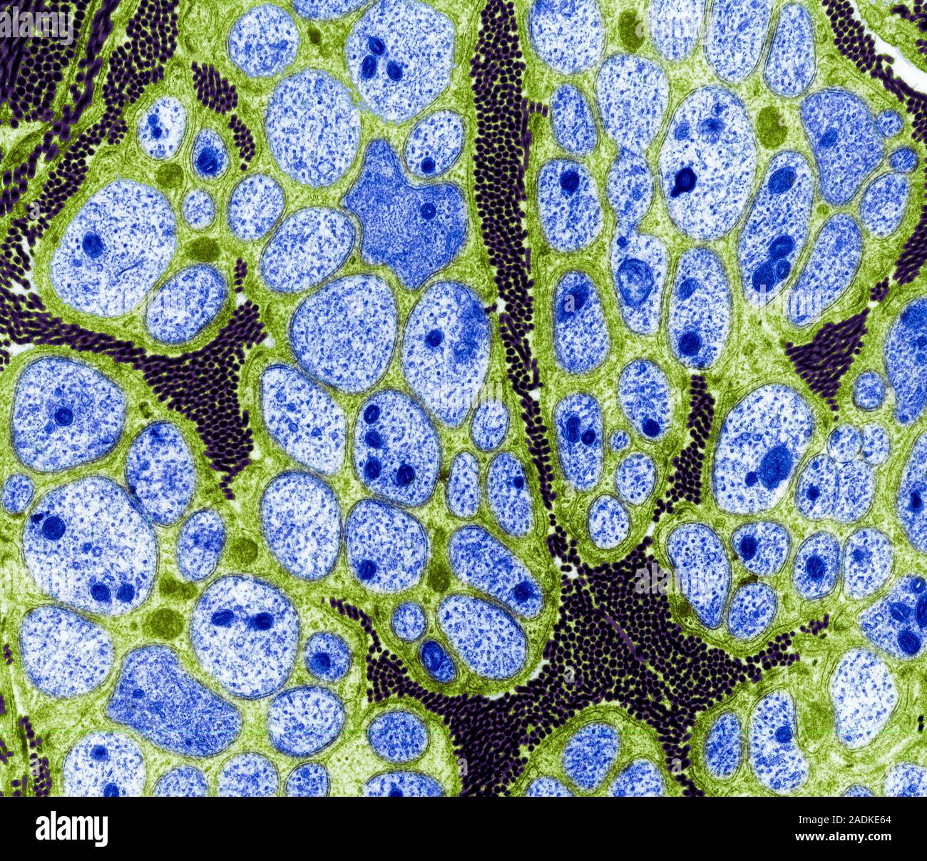 Nerve fibres. Coloured transmission electron micrograph (TEM) of a ...