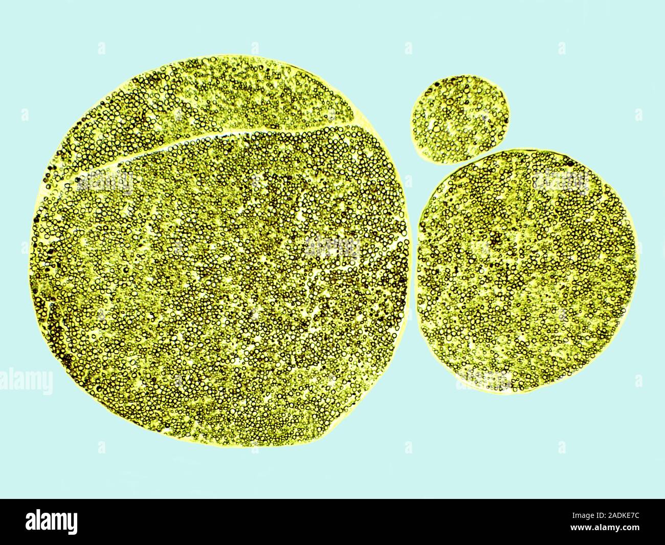 Nerve fibres. Coloured light micrograph of a transverse section through ...