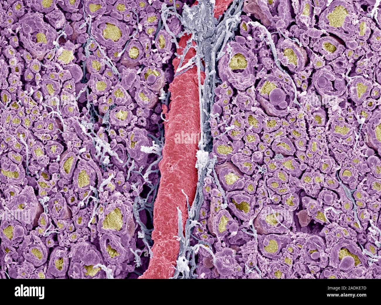 Myelinated nerve fibres. Coloured scanning electron micrograph (SEM) of ...