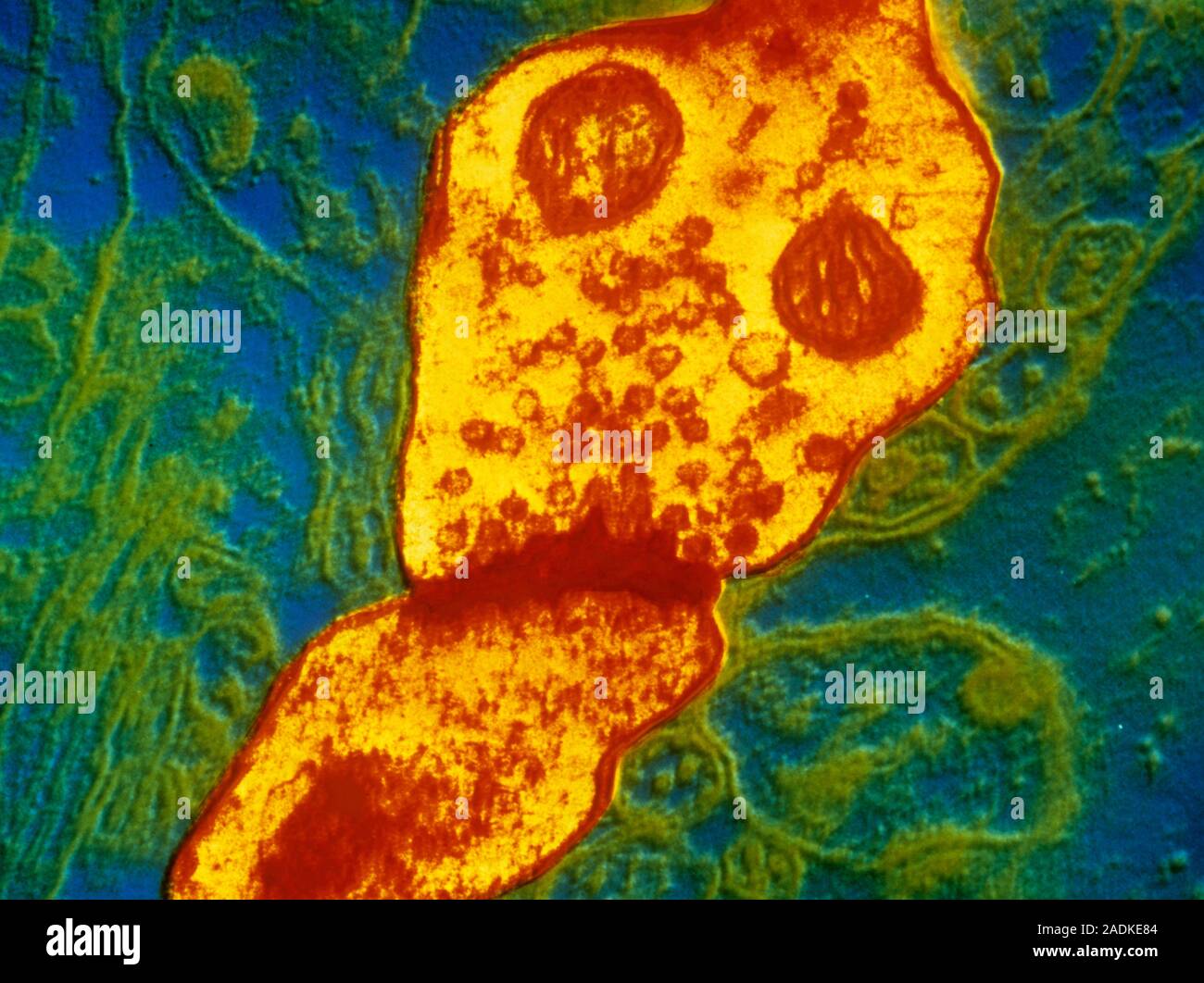 False-colour transmission electron micrograph of a synapse, or junction ...