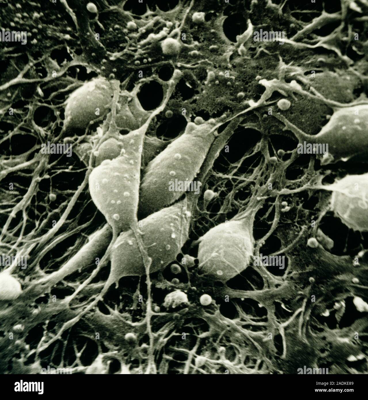 Scanning electron micrograph (SEM) of neurones (nerve cells) from the ...
