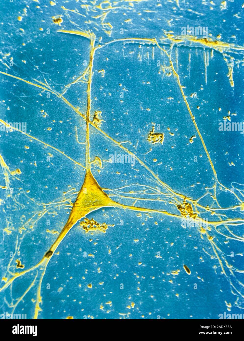 False-colour scanning electron micrograph (SEM) of a multipolar neuron ...