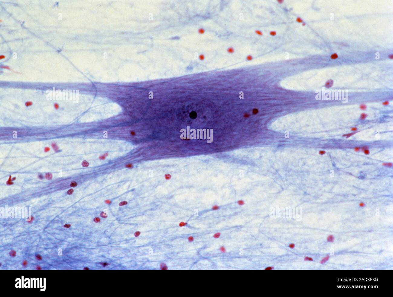 Light micrograph of a single, multipolar nerve cell body from the inner ...