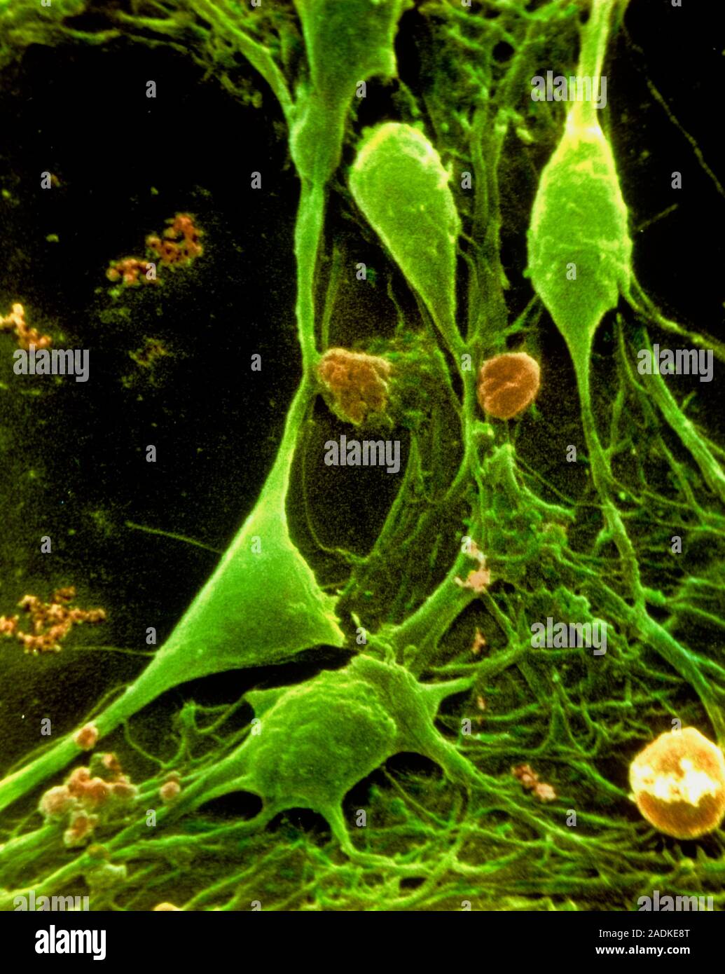 Scanning electron micrograph (SEM) of neurones (nerve cells) from the ...