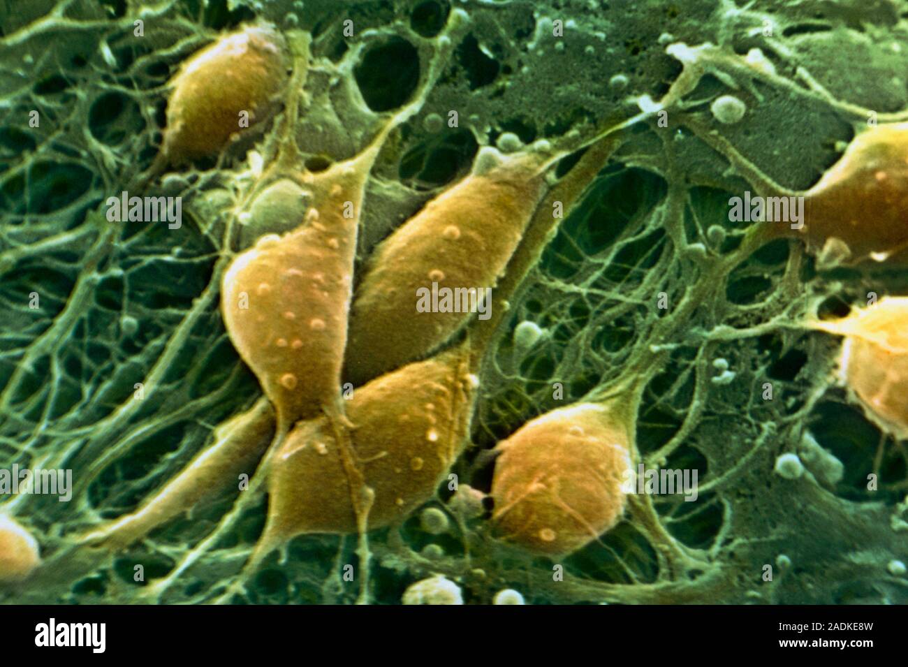 False-colour scanning electron micrograph (SEM) of neurones, or nerve ...