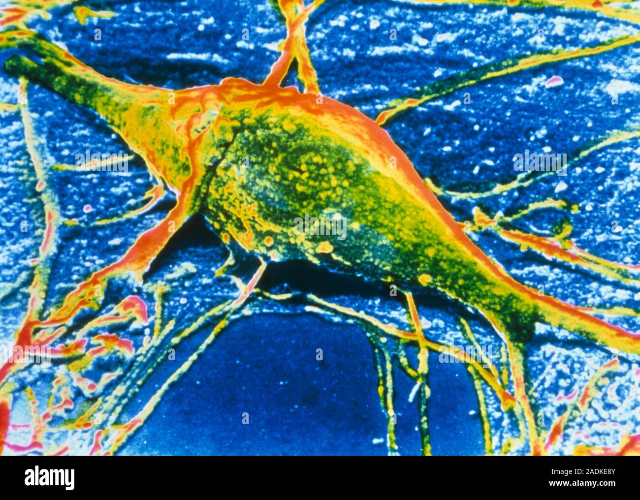 False-colour scanning electron micrograph (SEM) of a single neurone ...