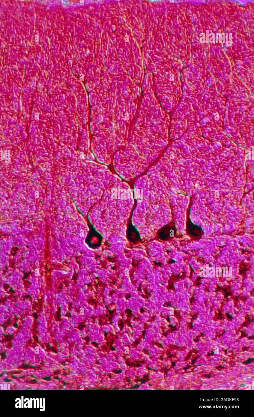Light micrograph of nerve tissue from the cerebellum, showing the ...
