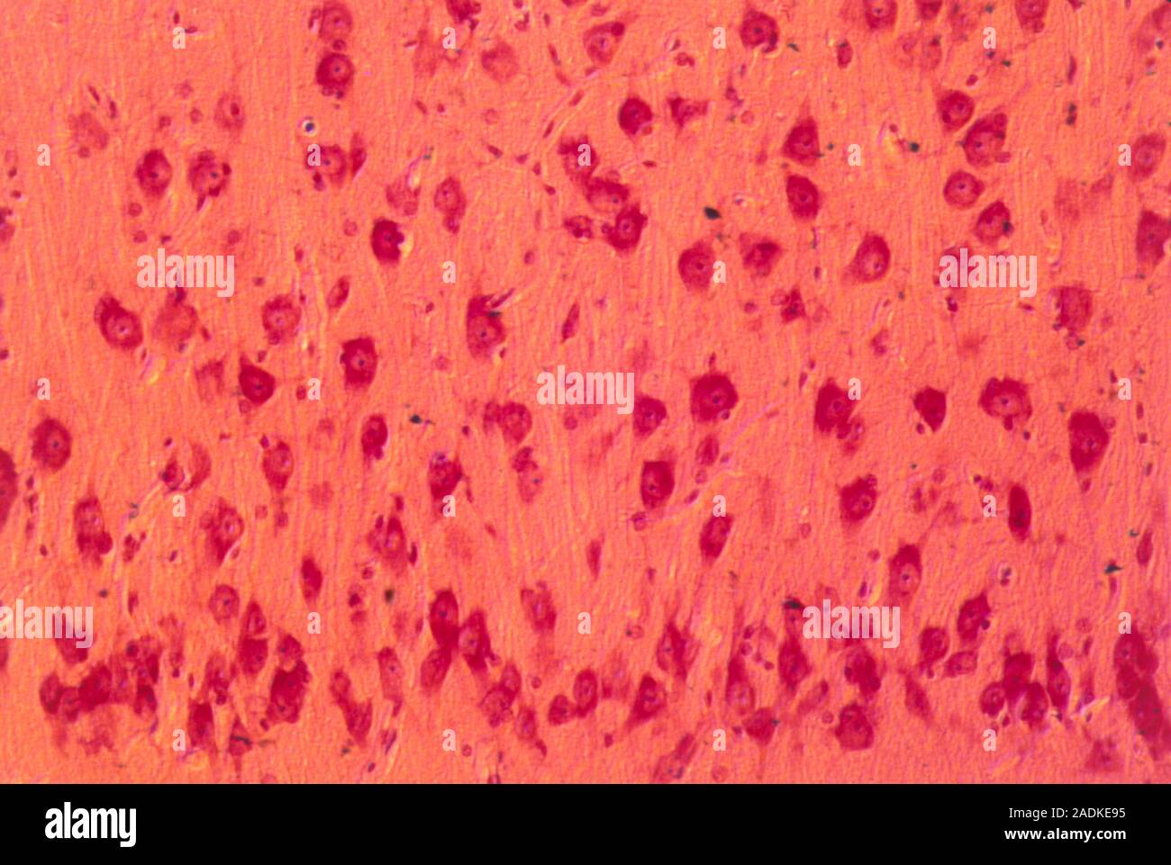 Light micrograph of nerve tissue from the cerebrum, the largest part of ...