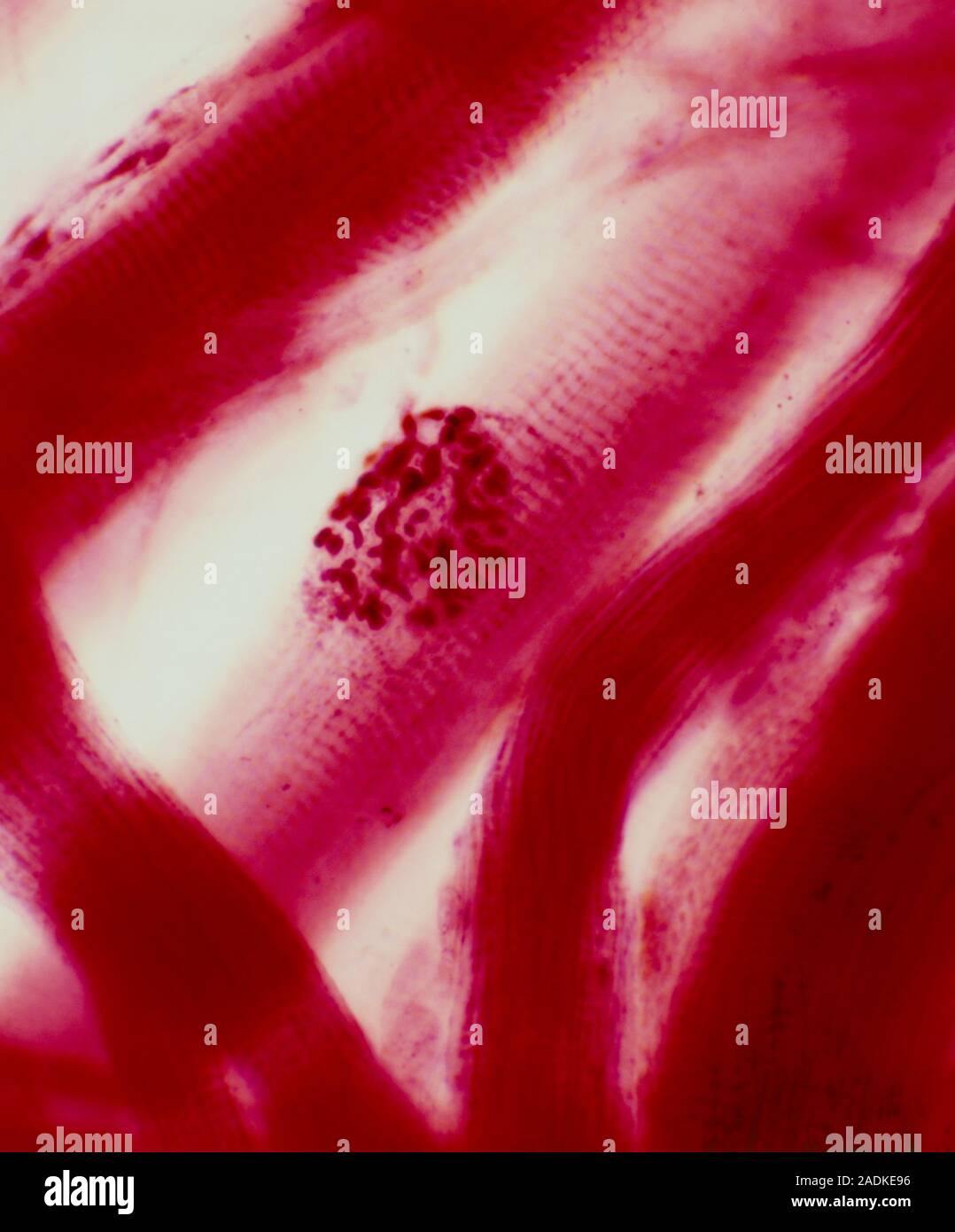 Light micrograph of a neuromuscular synapse (dark speckled oval), the ...