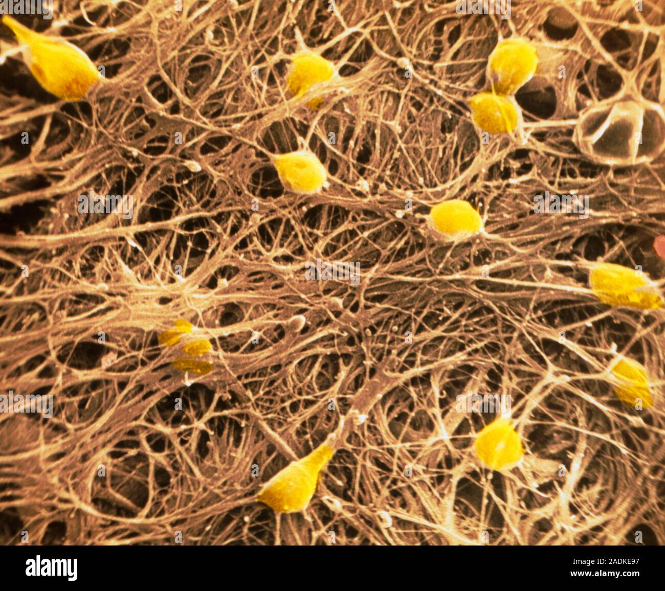 False-colour scanning electron micrograph (SEM) showing neurones (nerve ...